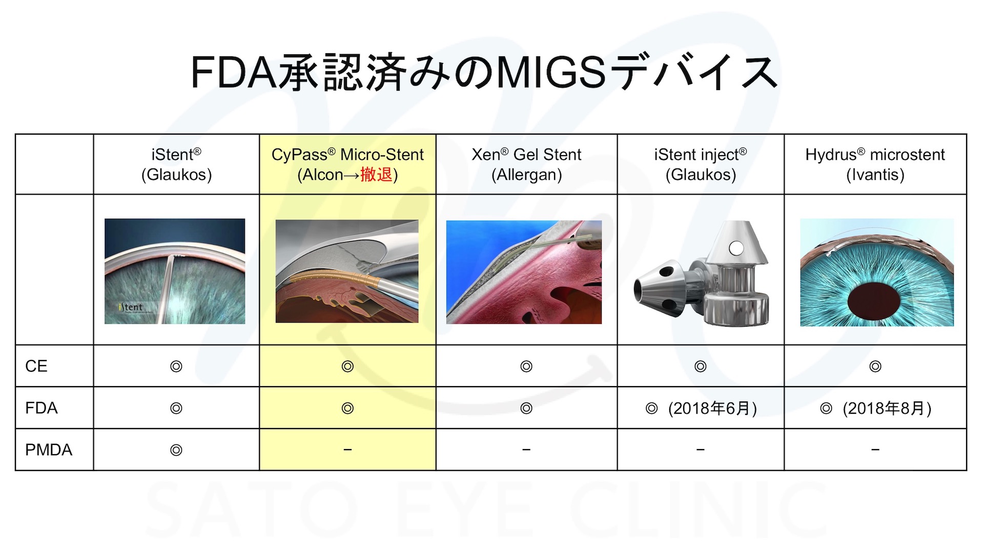MIGS devices | サトウ眼科（つくば市） 院長ブログ