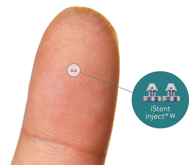 iStent inject W（低侵襲緑内障手術：MIGS） | サトウ眼科（つくば市） 院長ブログ