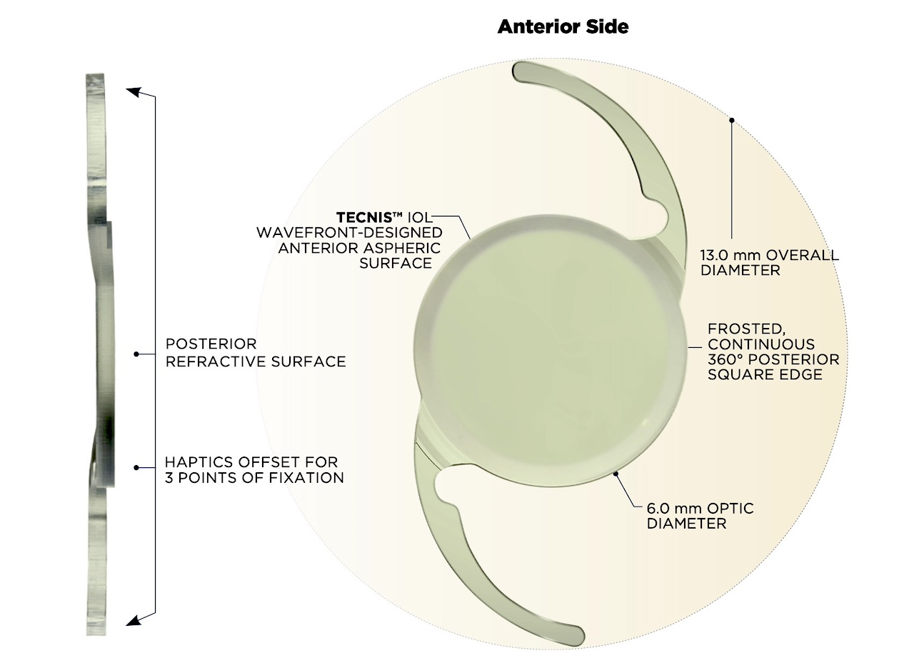 TECNIS PureSee IOL | サトウ眼科（つくば市） 院長ブログ